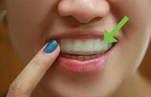 14 DIY Retainer Projects - How To Make A Retainer - DIYnCrafty